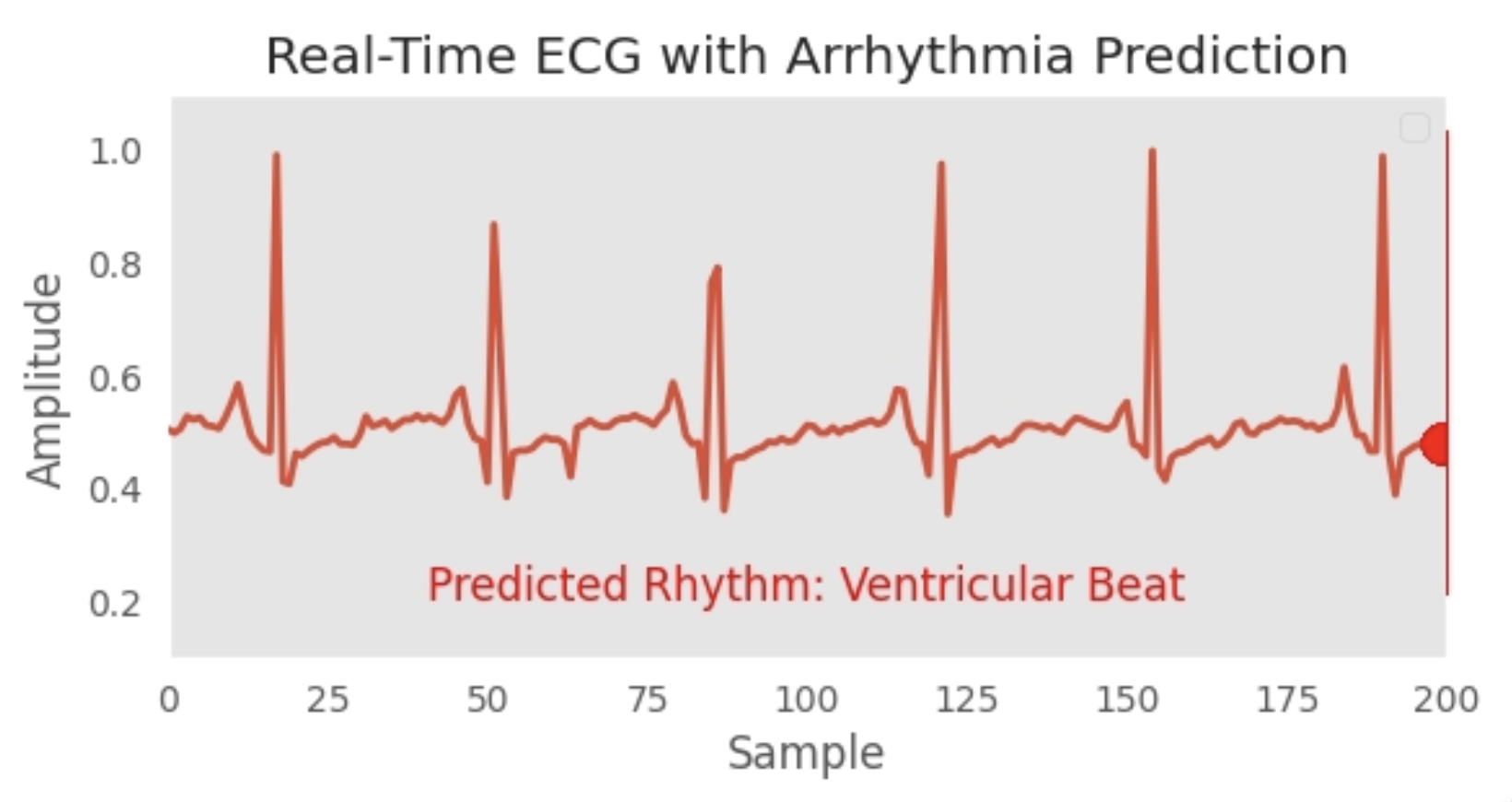 ECG Rhythm Interpretation